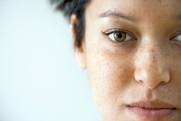 Are Sunspots Permanent? - FCMC Cosmetics